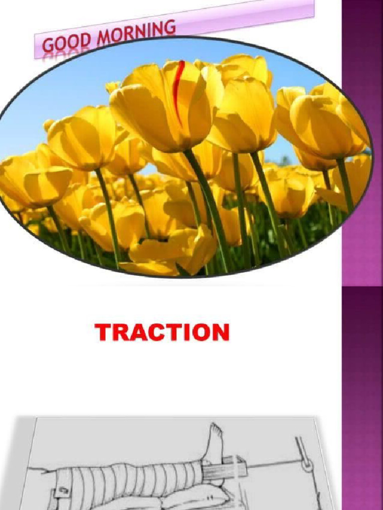 Traction | PDF