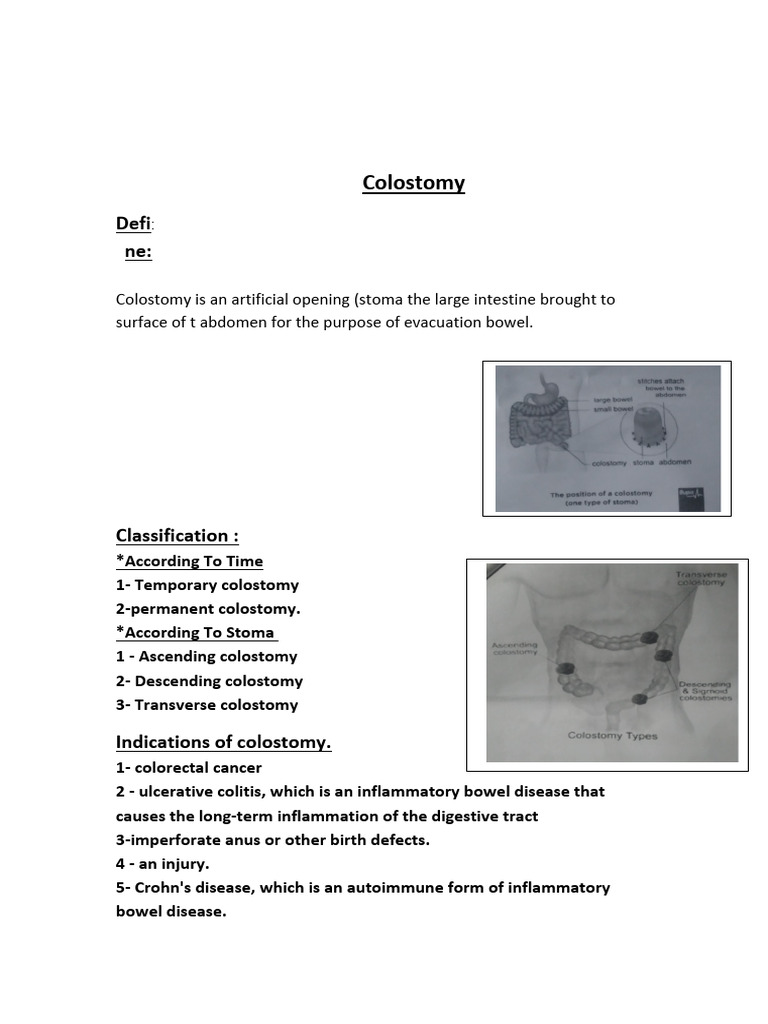 Understanding Colostomy: Types & Care | PDF