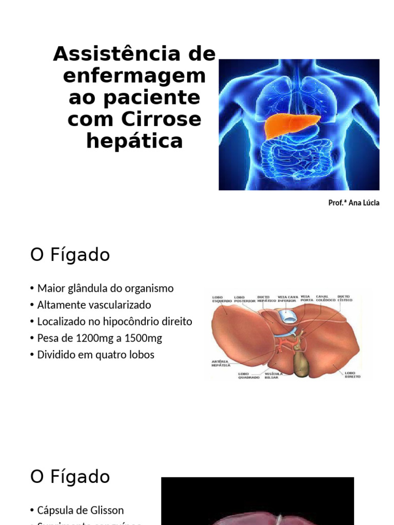 Assistência de Enfermagem Ao Paciente Com Cirrose Hepática | PDF ...
