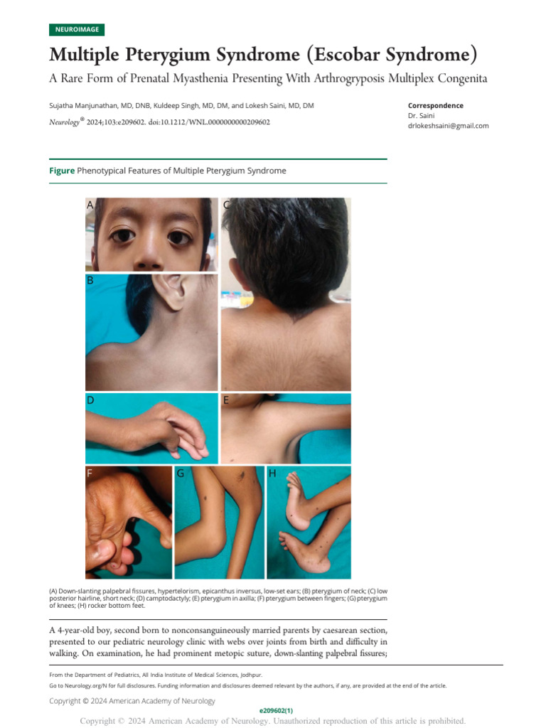 Syndrome Escobar | PDF | Human Diseases And Disorders | Genetics