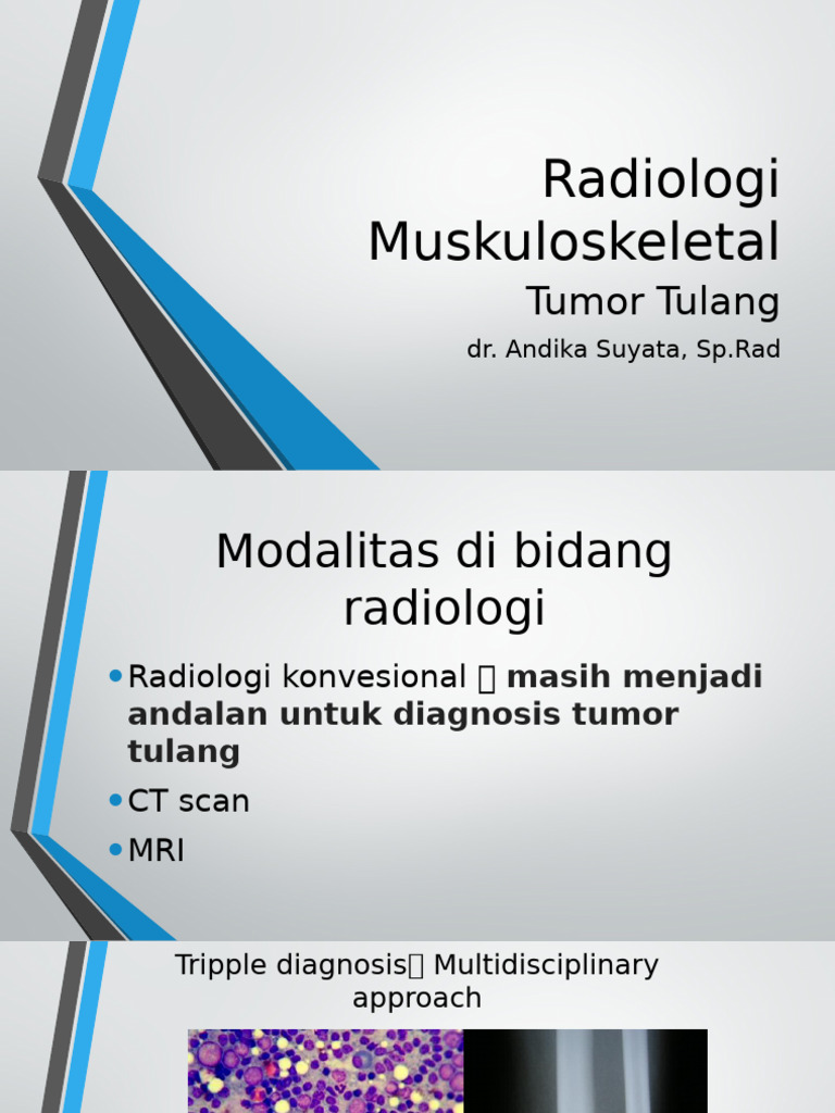 Diagnosis Tumor Tulang dengan Radiologi | PDF | Benign Tumor | Bone