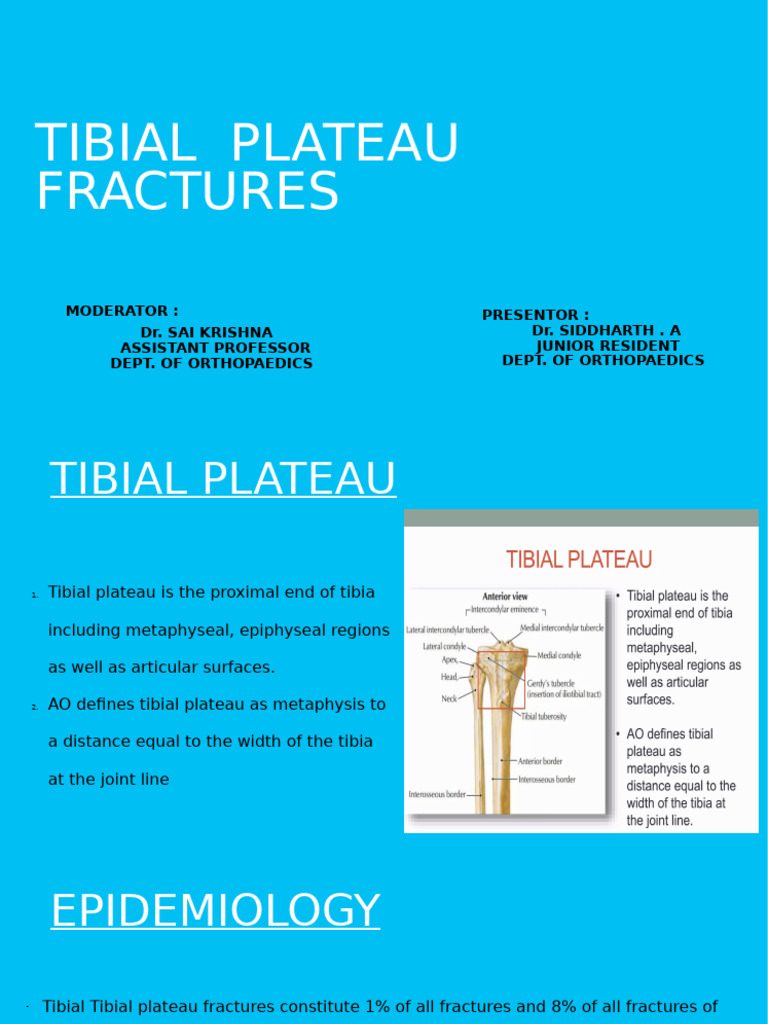 Tibial Plateau Fractures | PDF | Knee | Limbs (Anatomy)