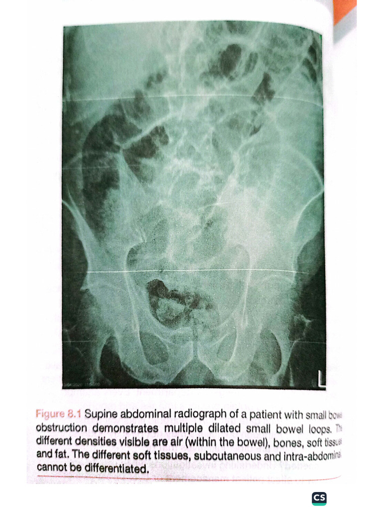 Diagnostic Imaging | PDF