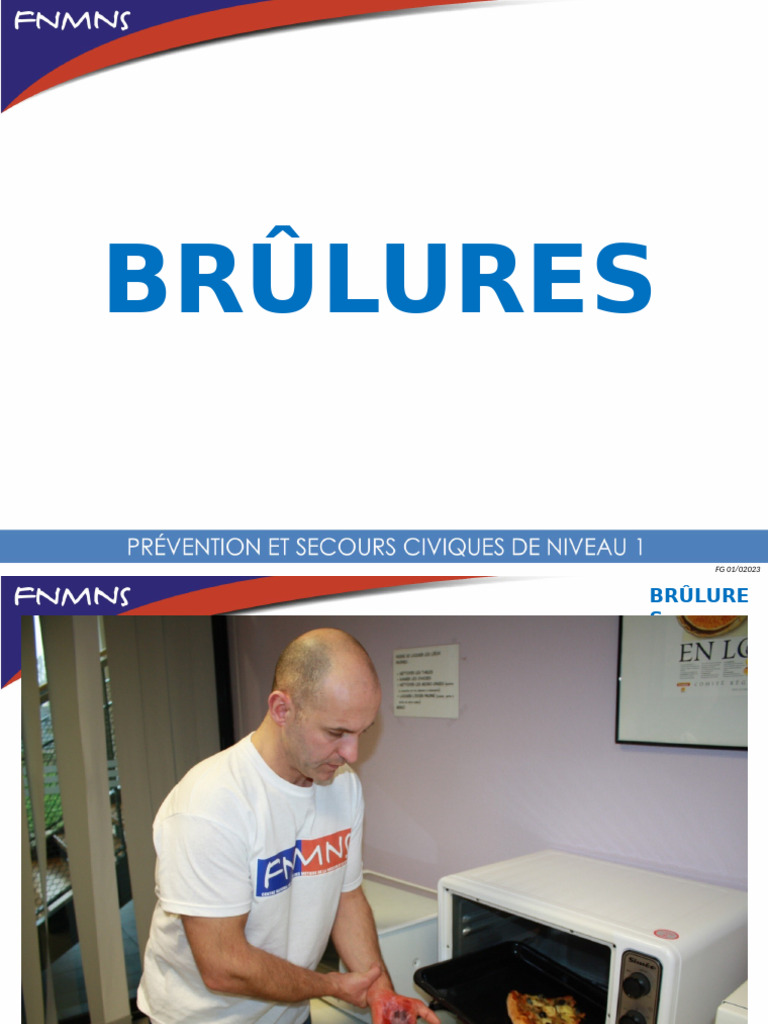 10 BRÛLURES | PDF | Brûlure | Médecine