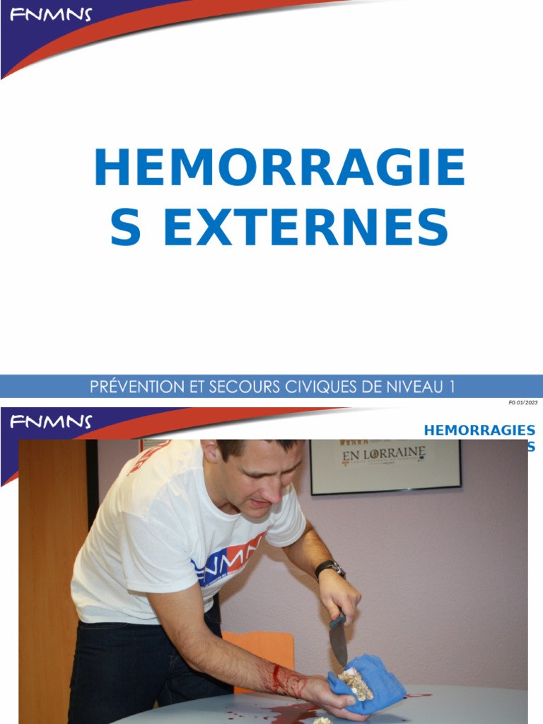 Hémorragies Externes : Causes et Secours | PDF | Saignement | Urgences ...