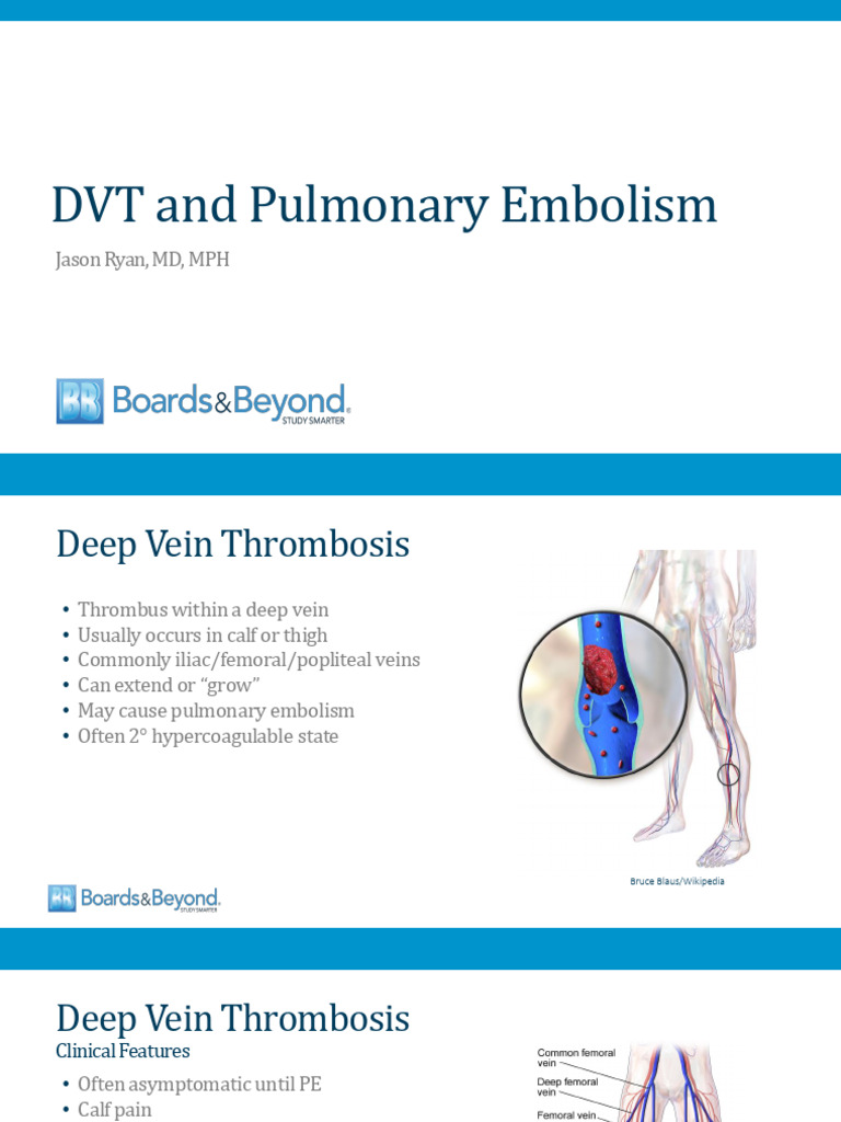 Dvt And Pe Diagnosis And Treatment Pdf Vein Thrombosis
