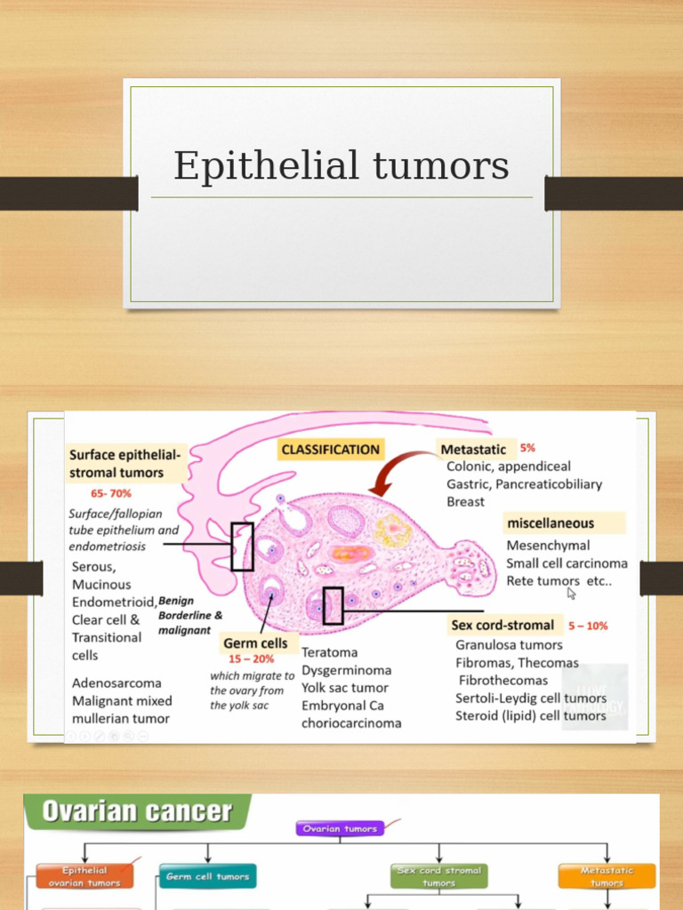 Overview of Epithelial Tumors | PDF | Ovarian Cancer | Neoplasms