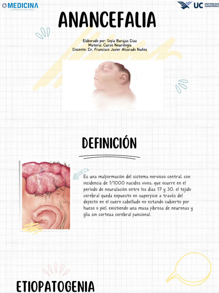 Anancefalia: Definición y Diagnóstico | PDF
