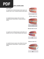 Clases de Angle | PDF | Anatomia dental | Diente
