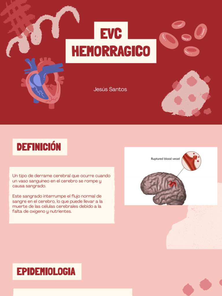 EVC Hemorrágico: Causas y Tratamiento | PDF | Carrera | Hipertensión