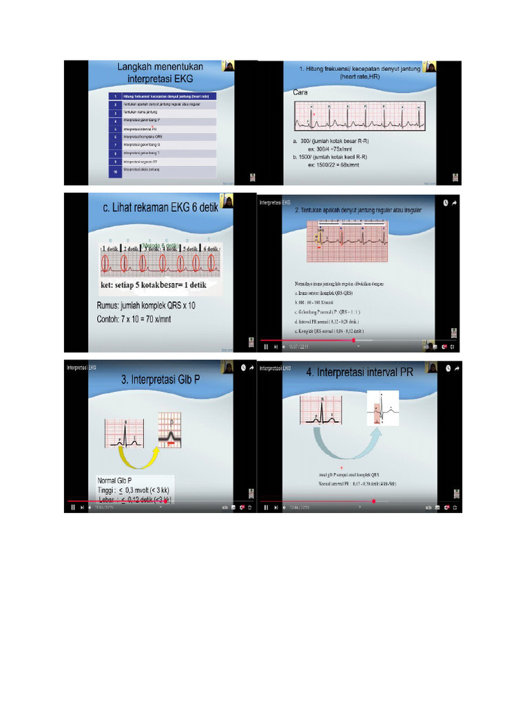 Interpretasi Ekg | PDF