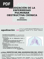 EPOC Clasificacion Anthonisen | PDF