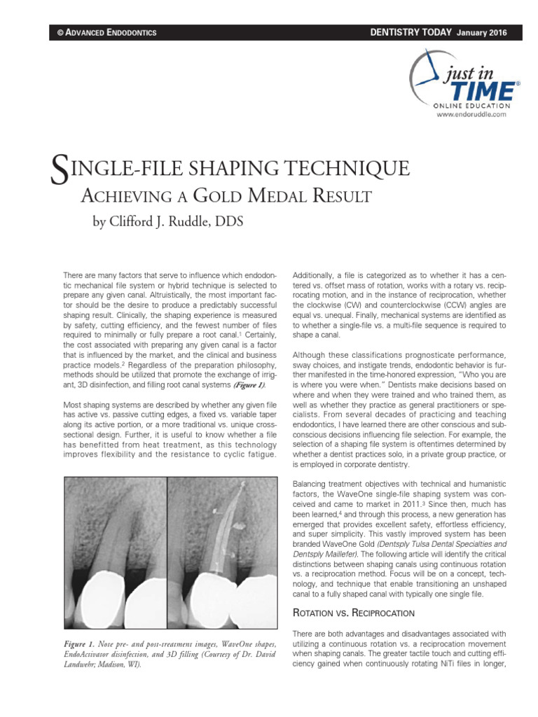 Endodontic File Systems Explained | PDF