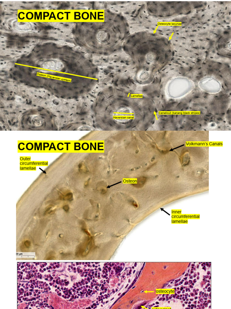 Anatomy of Bone Types and Structures | PDF