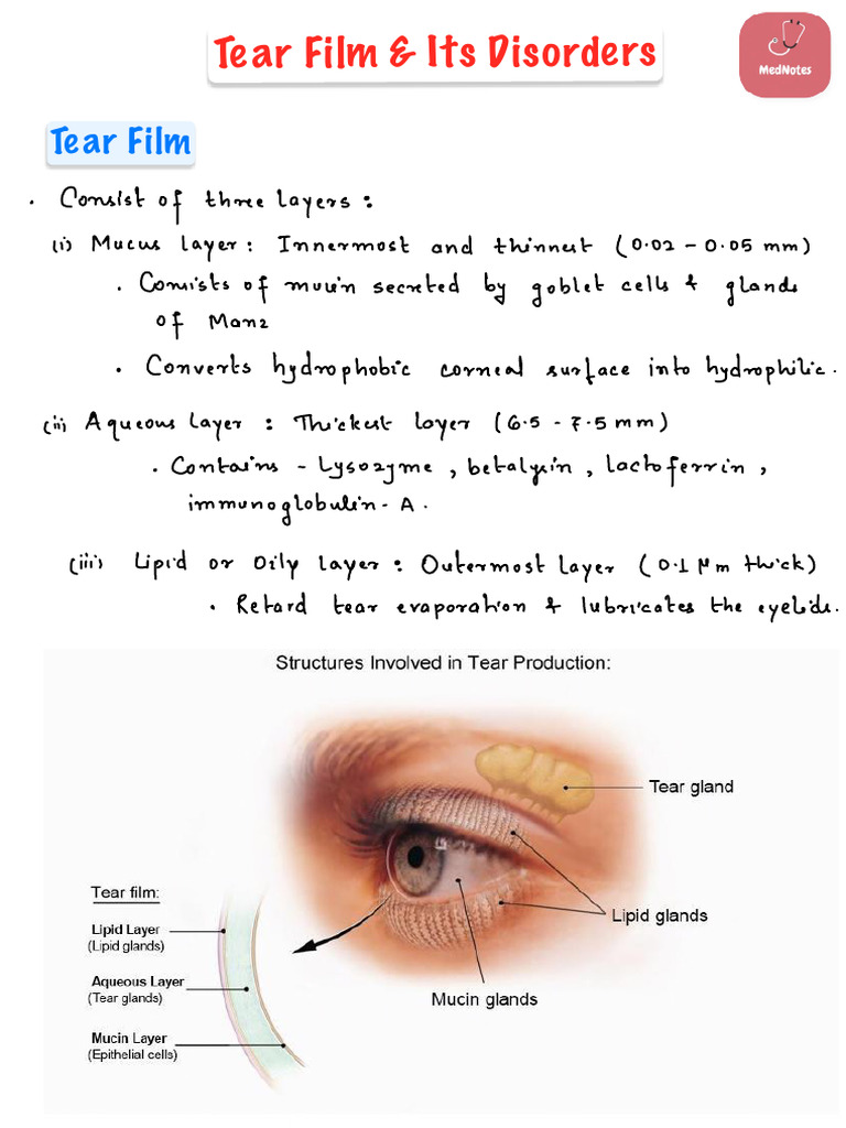 2. Tear Film - Its Disorders | PDF | Cornea | Human Eye