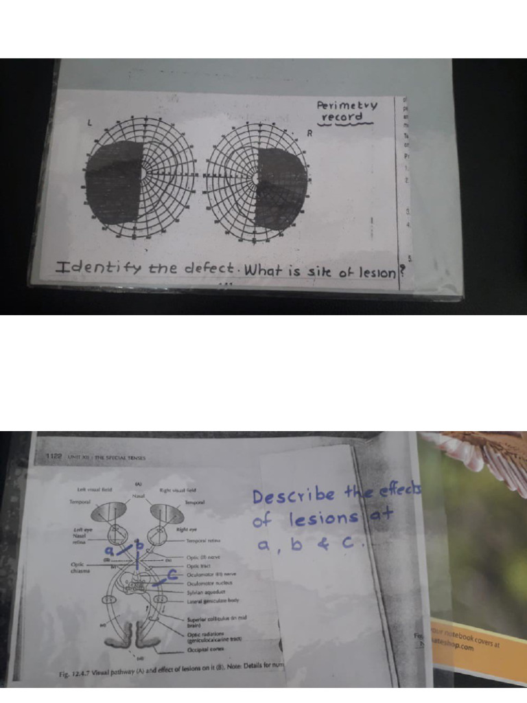 physiology spots_230218_175720 | PDF