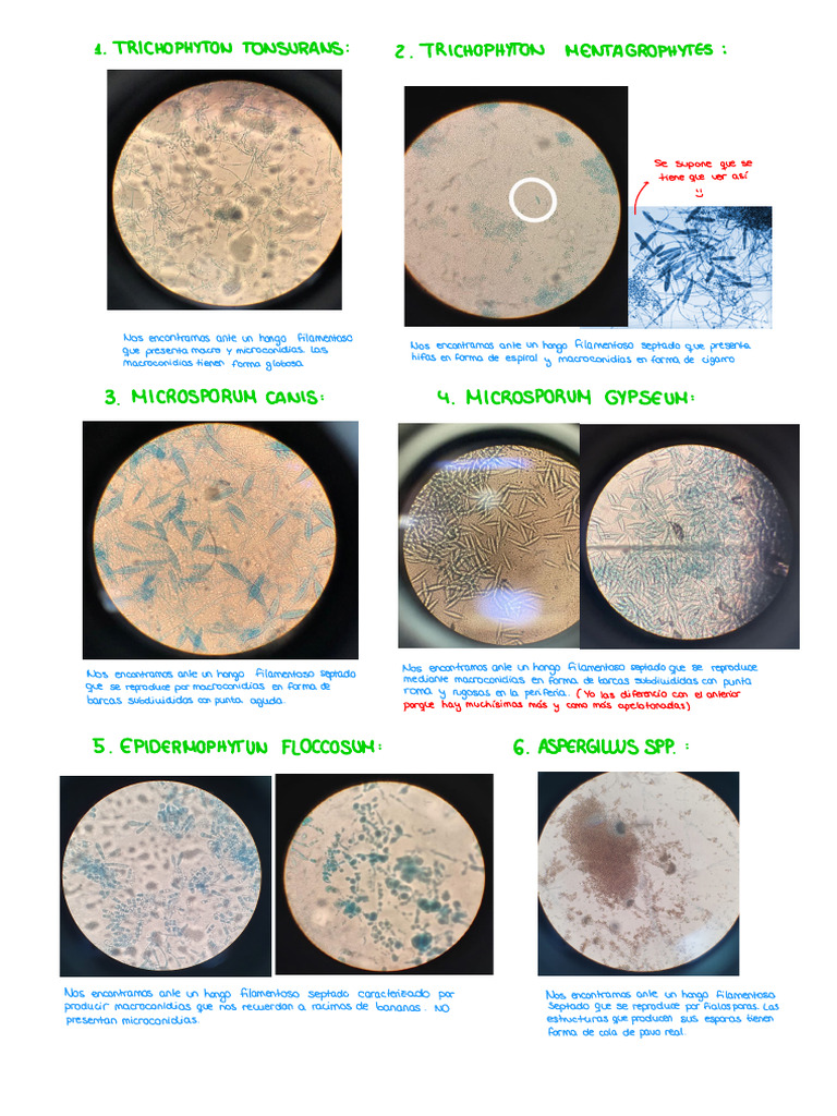 Microconidios en hongos filamentosos | PDF | Organismos | Eucariotas