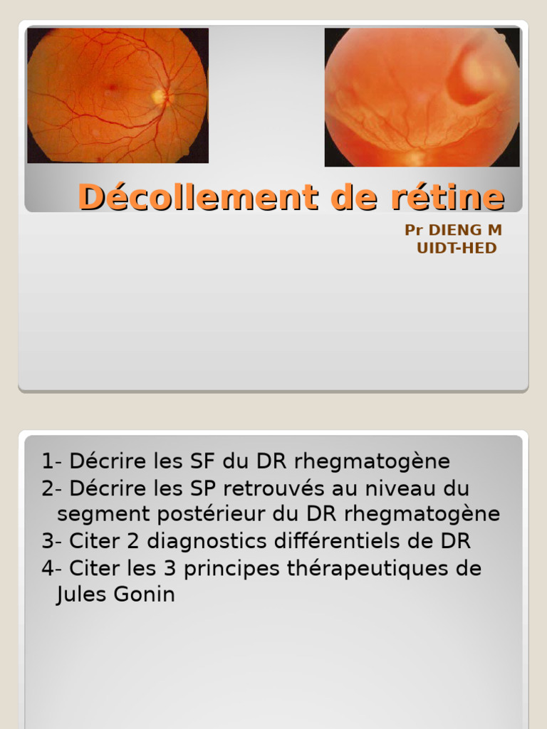 Décollement de rétine | PDF | Rétine | Système visuel