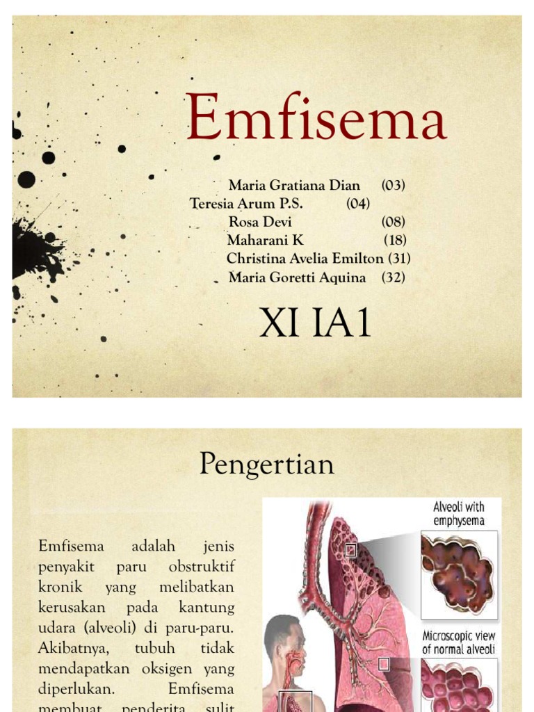 Emfisema | PDF