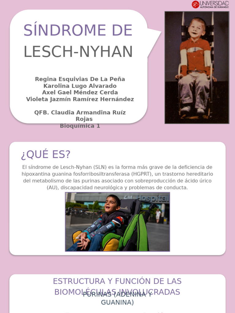 Síndrome de Lesch Nyhan Pre Bioca | PDF | Medicina CLINICA ...