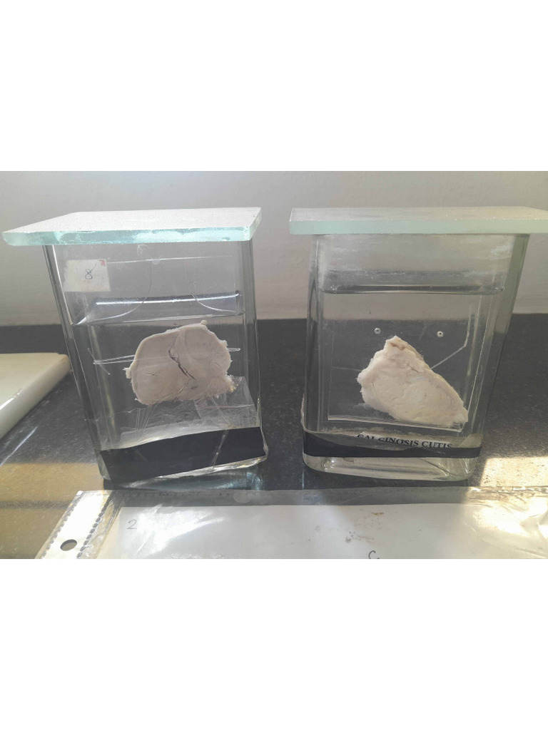 Pathology Specimen | PDF