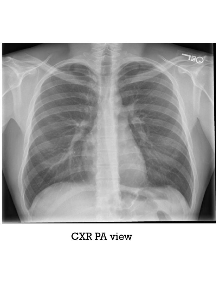Respiratory Radiology | PDF