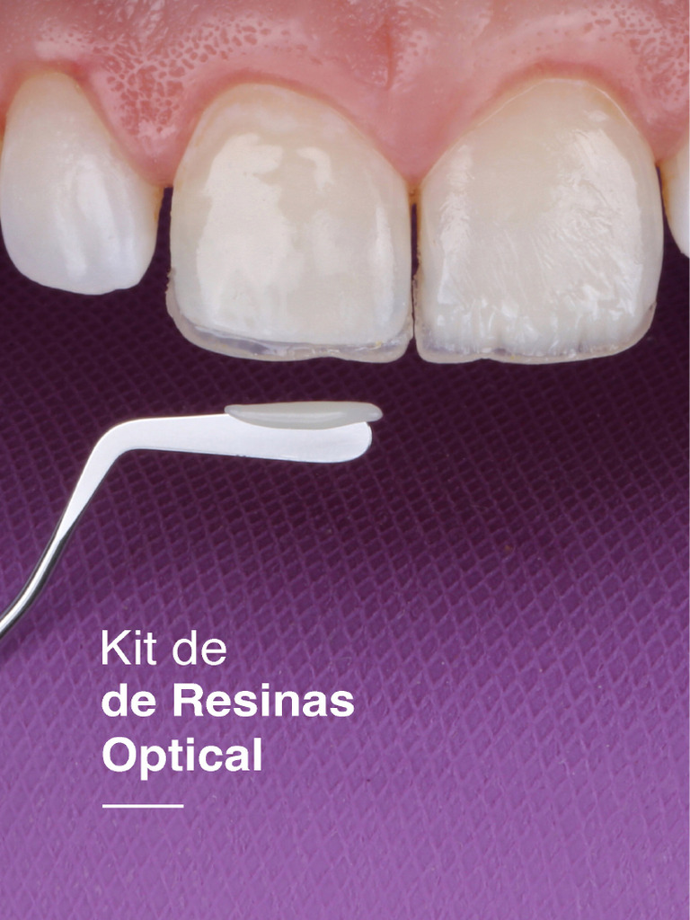 (ES) Kit Resinas | PDF