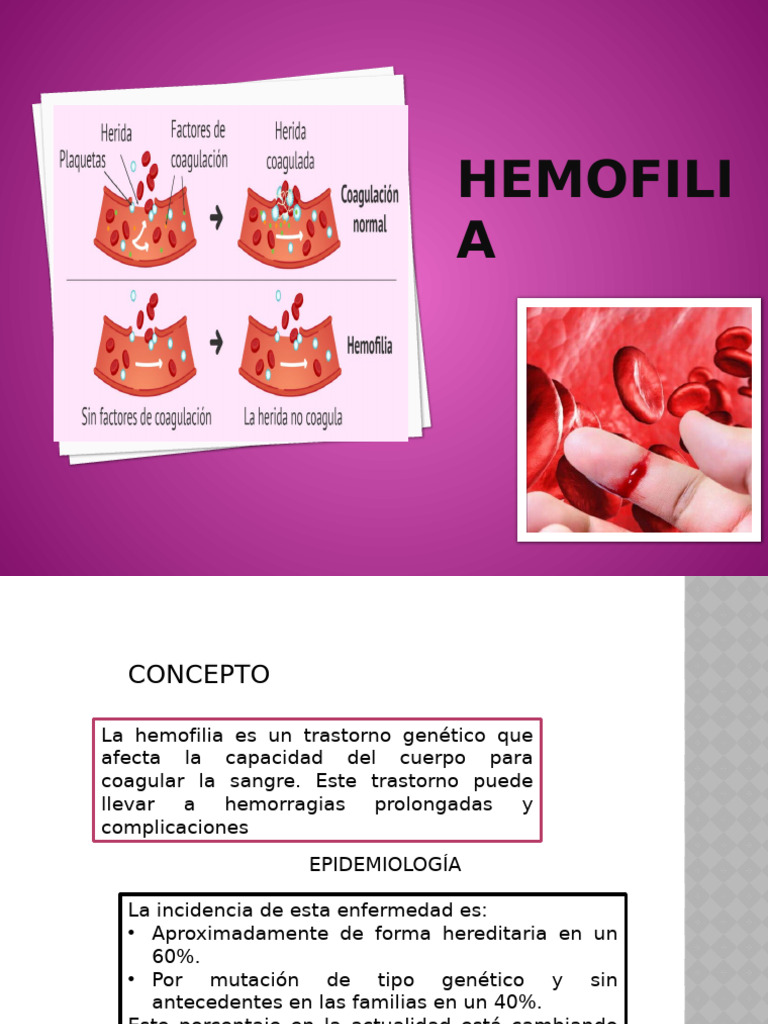 HEMOFILIA | PDF | Hemofilia | Coagulación