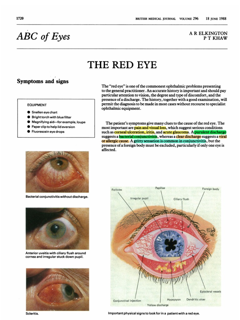 ABC of Red Eye | PDF | Glaucoma | Diseases Of The Eye And Adnexa
