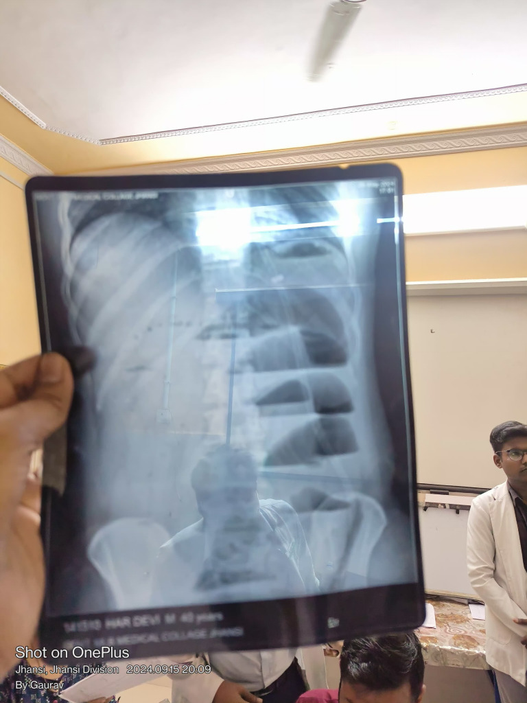 Xray Surgery | PDF