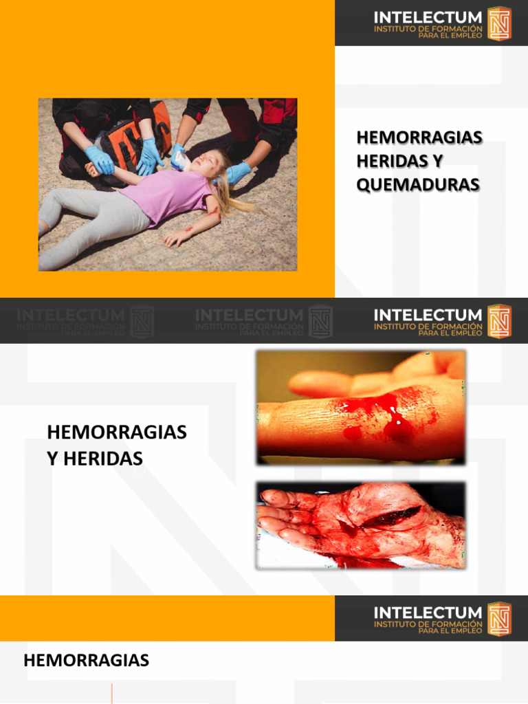 Hemorragias Heridas y Quemaduras. | PDF | Herida | Sangrado