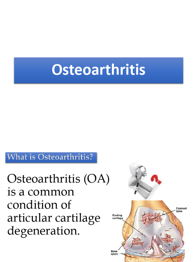 OA Management Treatment F | PDF | Osteoarthritis | Diseases And Disorders