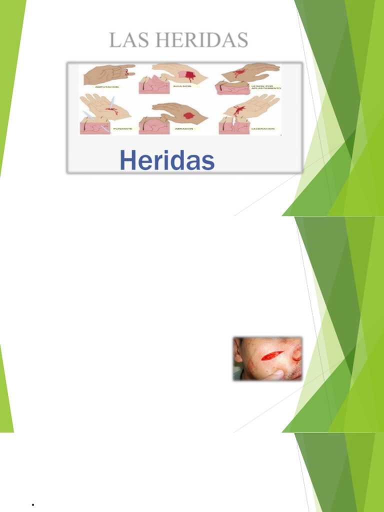 Las Heridas | PDF | Herida | Enfermedades y trastornos