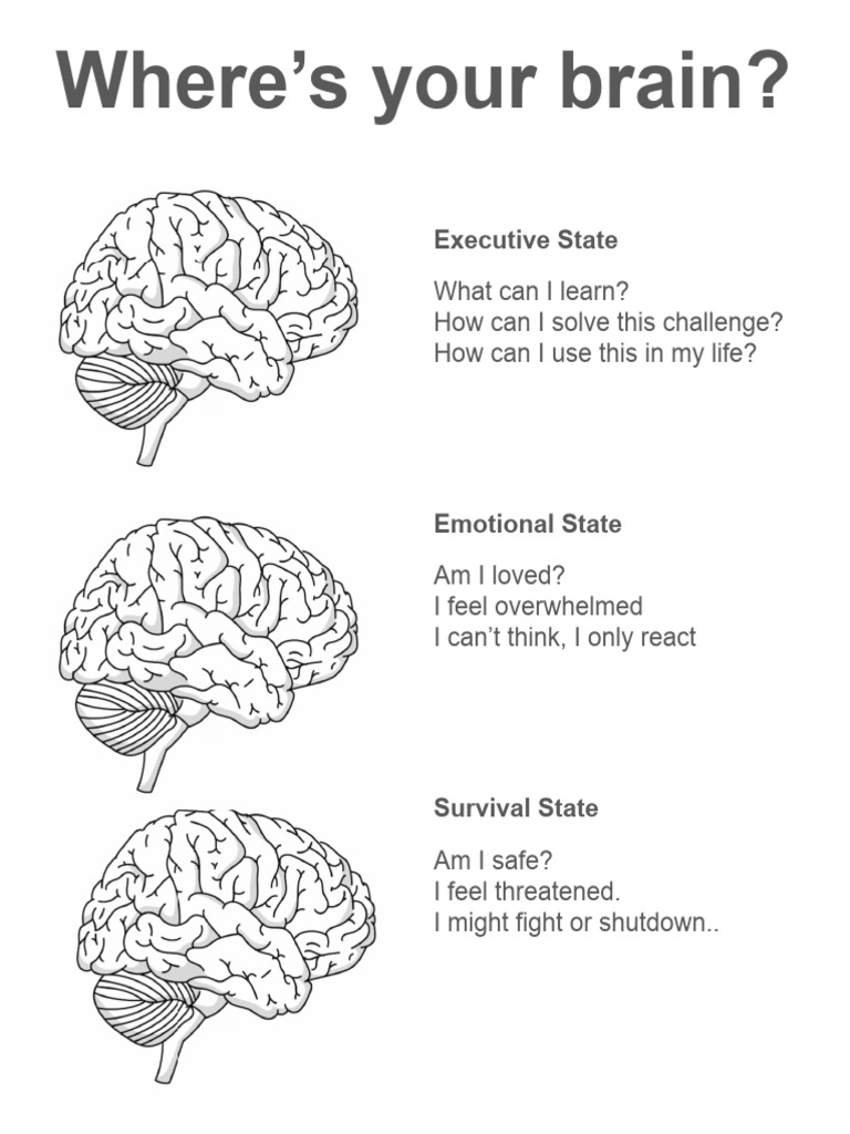 Where's Your Brain | PDF