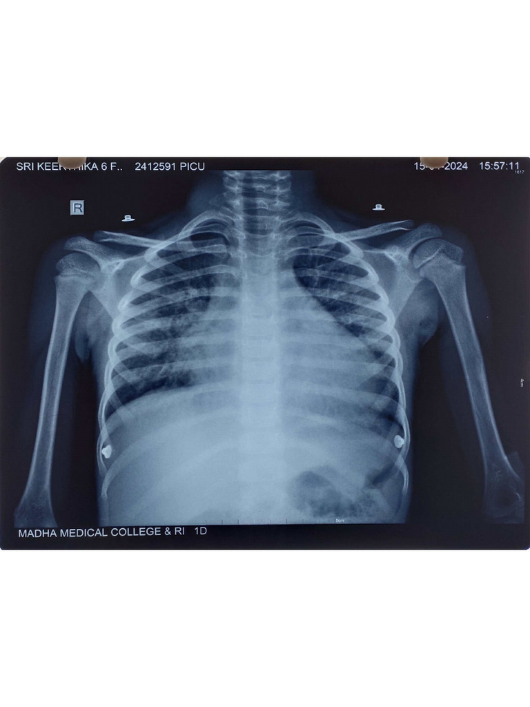 Pedia X Ray | PDF