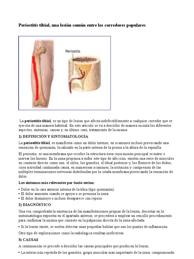 Periostitis tibial: causas y tratamiento | PDF | Corriendo | Dolor