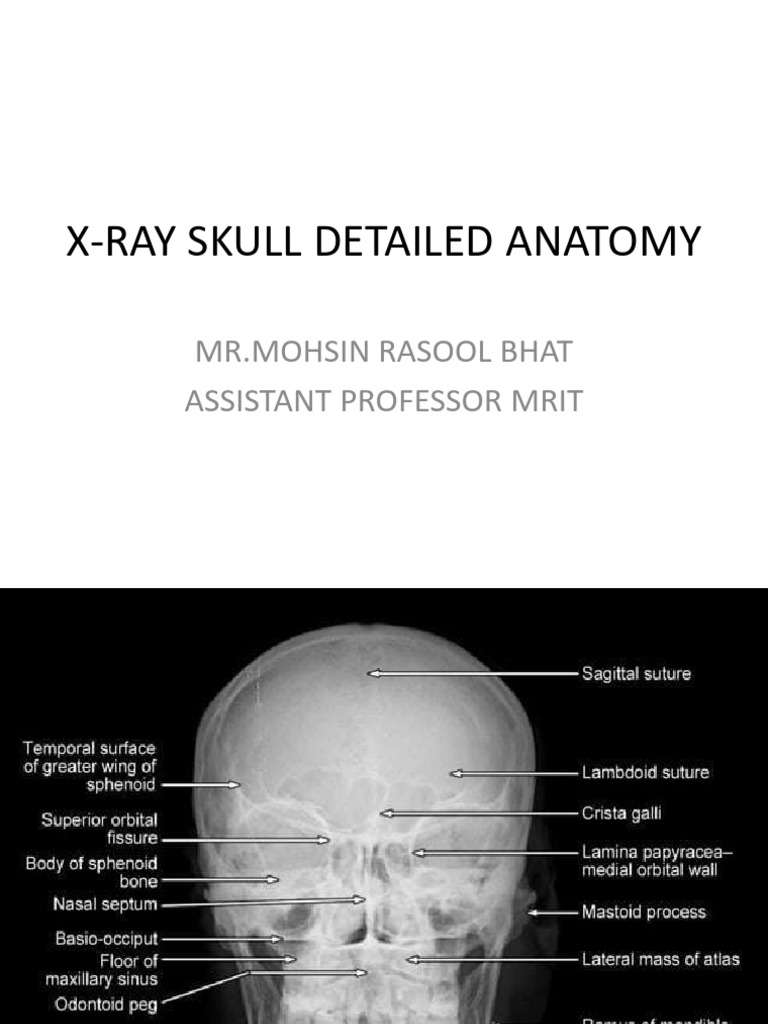 16457 Skull Anatomy Brief Pdf