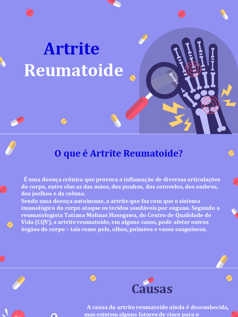 Artrite Reumatoide: Causas e Tratamento | PDF | Artrite | Artrite ...