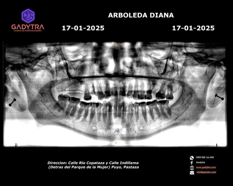 Arboleda 3 | PDF