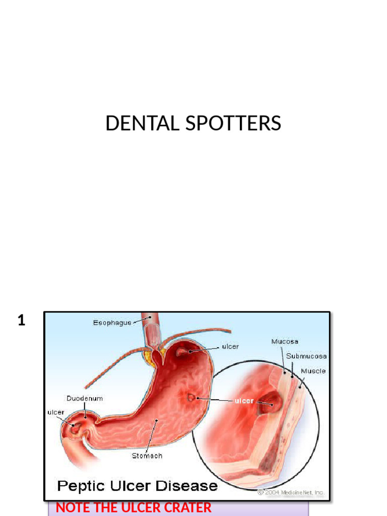 Dental Spotters | PDF | Insulin | Drugs