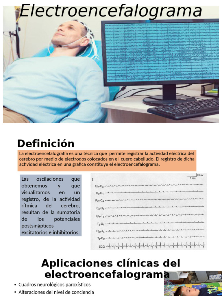 Electroencefalograma: Definición y Usos | PDF | Electroencefalografía ...