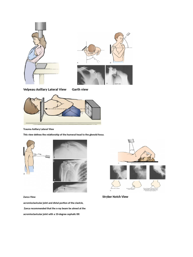 shoulder additional view 12 | PDF