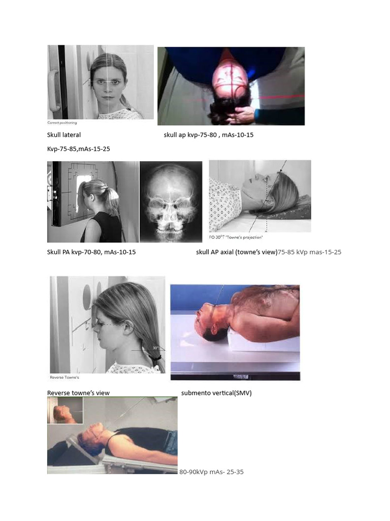 Facial and Skull Bone Positioning | PDF