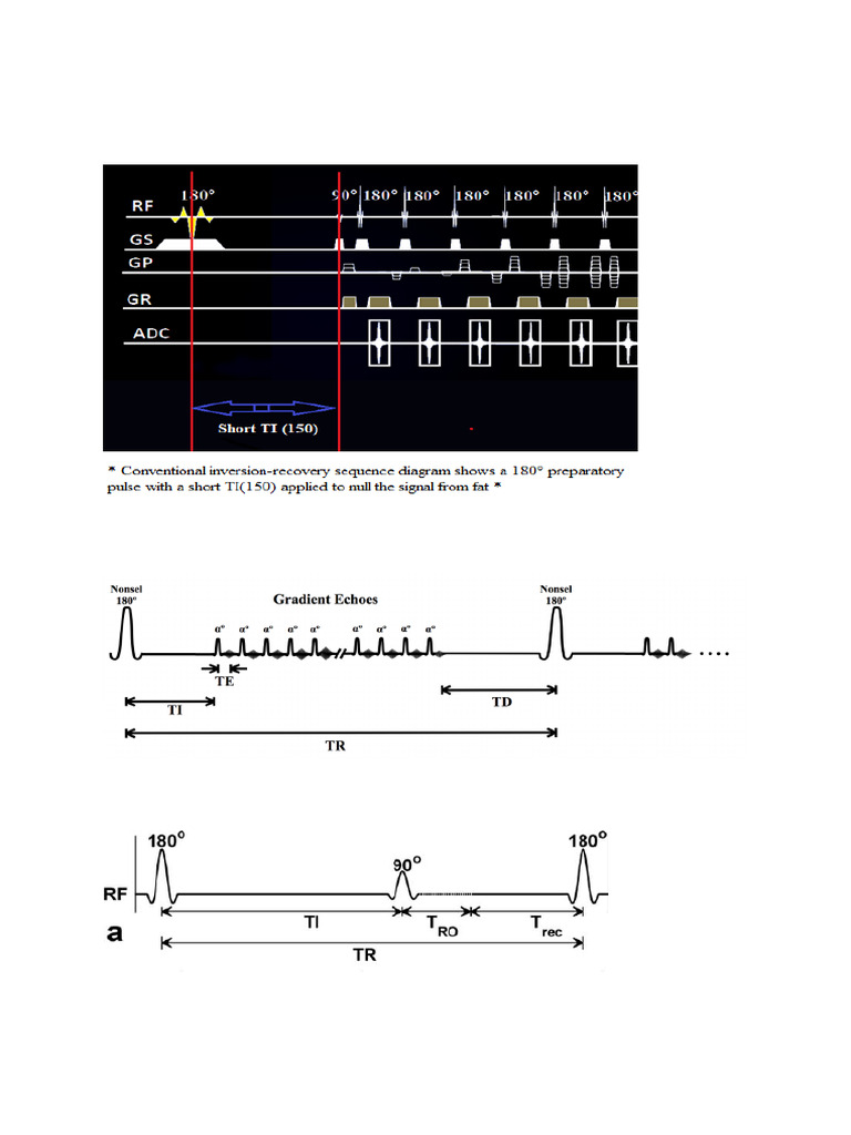 Different Types of Inversion Recovery Sequences | PDF | Magnetic ...