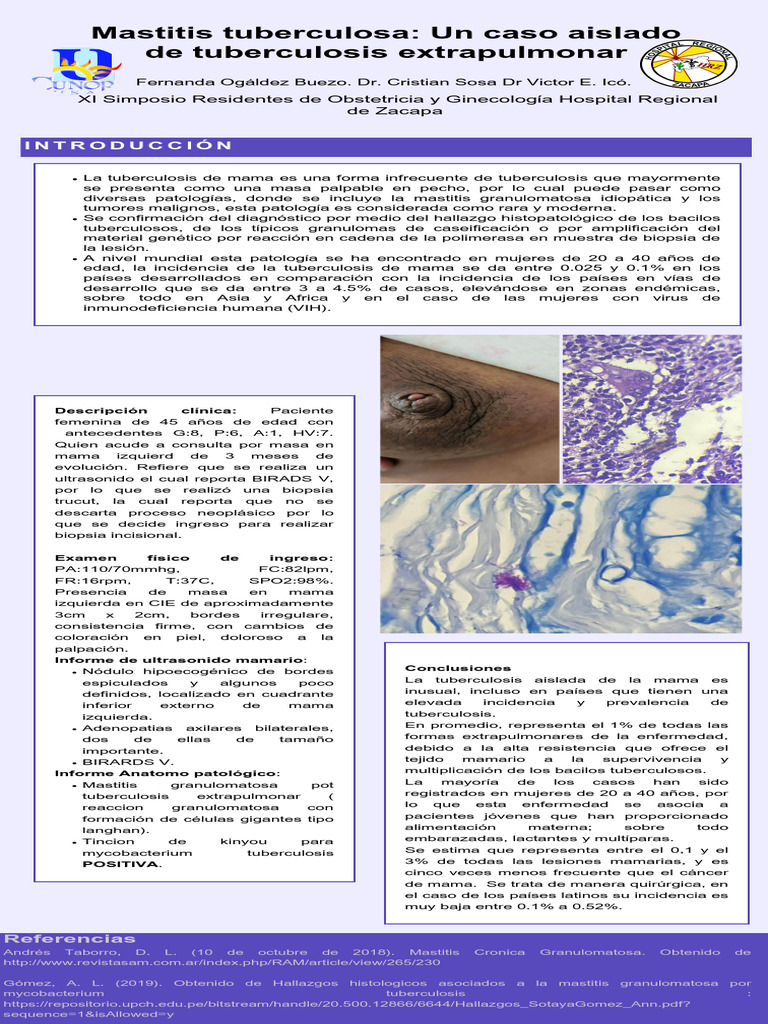 Mastitis Tuberculosa | PDF | Pecho | Tuberculosis