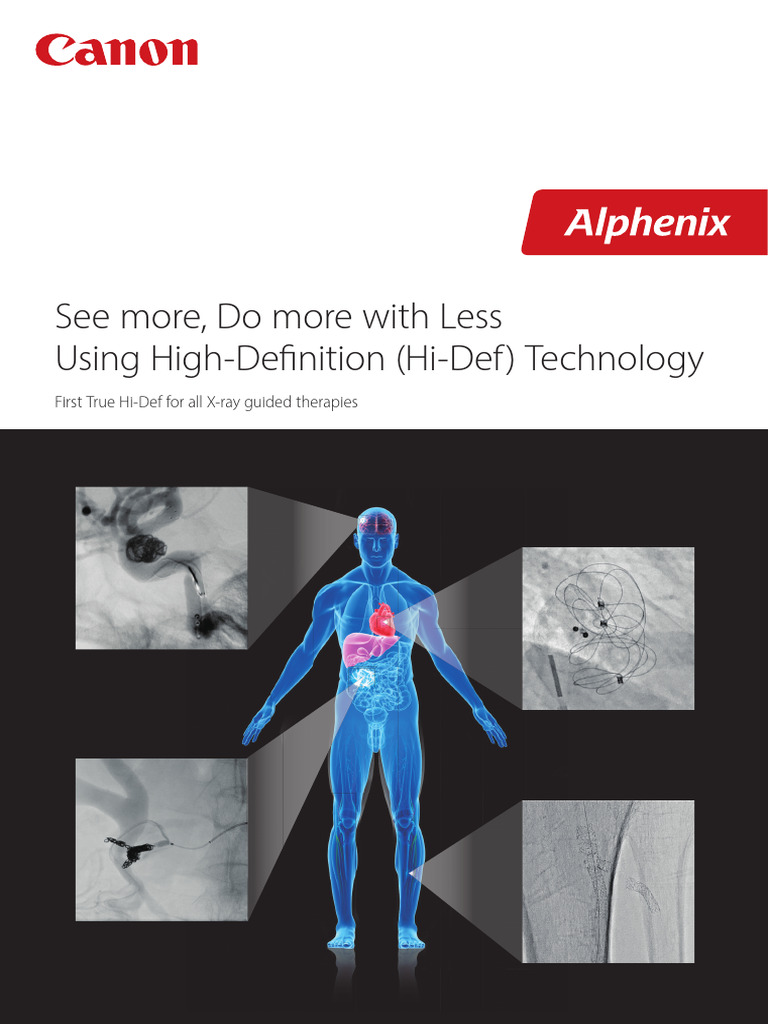 See More, Do More With Less Using High-Defi Nition (Hi-Def) Technology ...
