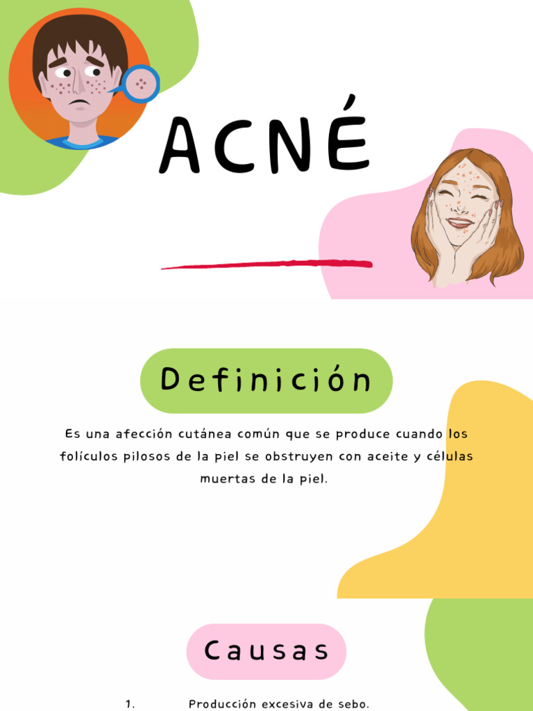 Causas y Tratamientos del Acné | PDF