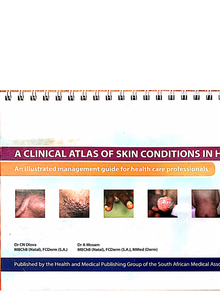 Atlas of Skin Conditions in Hiv PDF | PDF