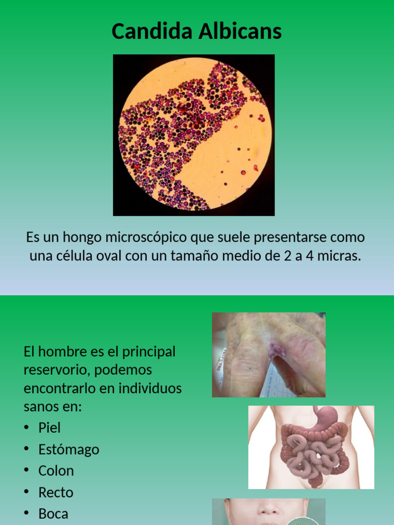Candida Albicans | PDF | Candidiasis | Especialidades Medicas