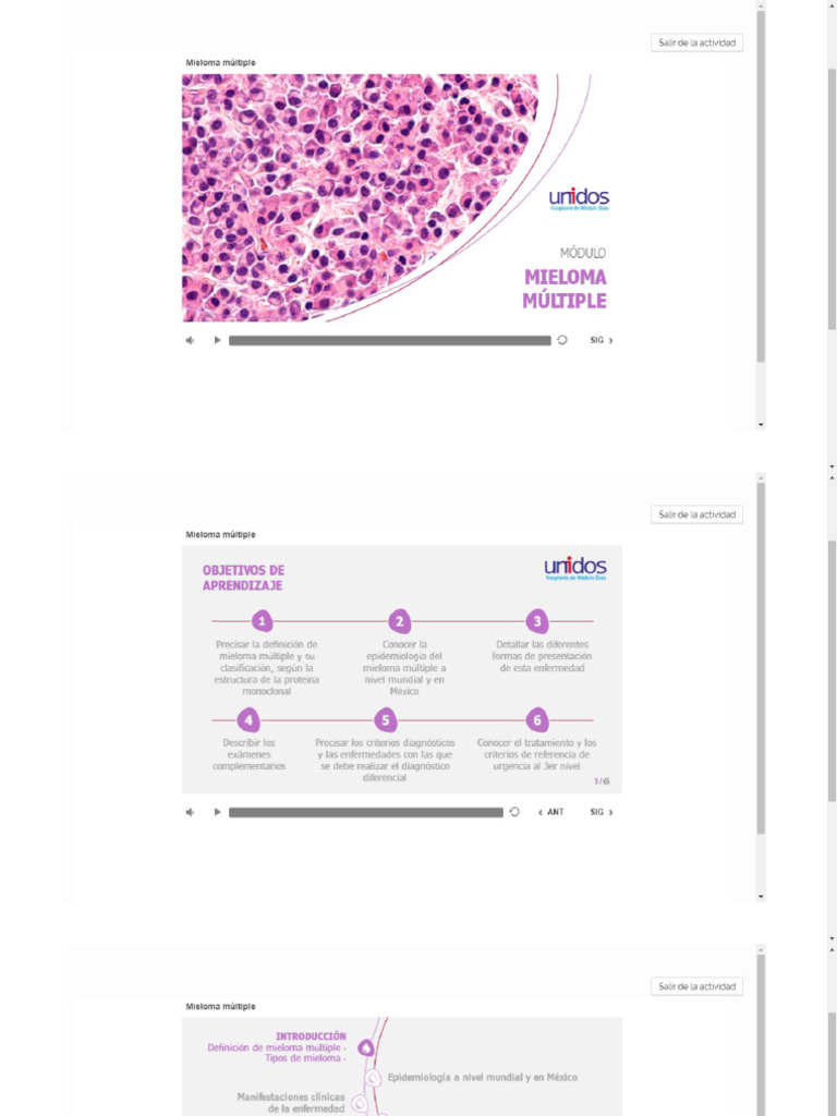 M2 Mieloma Múltiple Curso Conectimed | PDF